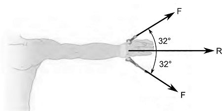 A patient with a dislocated shoulder is put into a traction apparatus ...