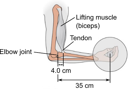 Using the information in the figure, calculate the tension in the ...