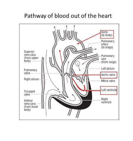 Aorta a) Right side of the heart b) Left side of the heart | Homework ...