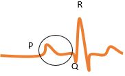 The highlighted portion of this ECG trace corresponds to ______. a ...
