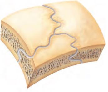 Identify each of the following structural joint types in the pictures ...