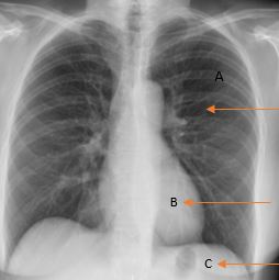 Organ identification. | Homework.Study.com