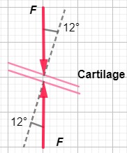 During vigorous downhill hiking, the force on the knee cartilage (the ...