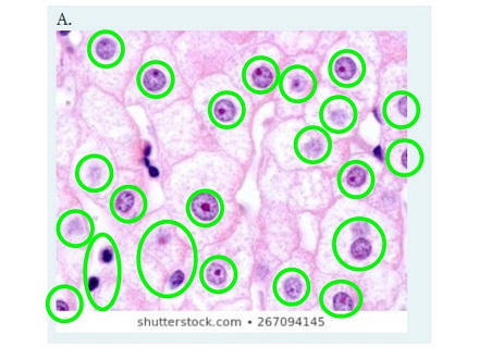 Calculate the total number of cells in photo A as shown below ...