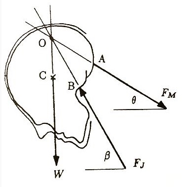 Consider the situation showed in figure below. What tension must the ...