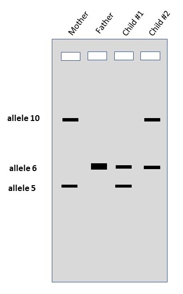 A heterozygous mother has an STR region with 5 repeats on one ...