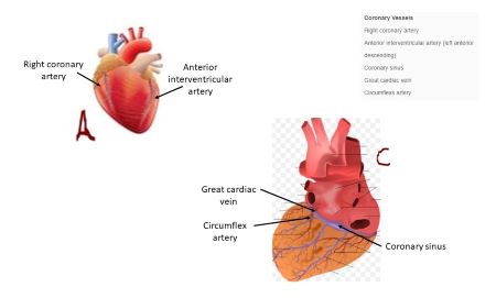 Label the three views of the heart in the figures with the following ...