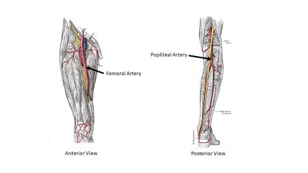 Fibular Artery Anterior View