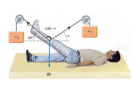 The leg and cast in Figure P4.18 weigh 290 N, with the center of mass as indicated by the blue ...