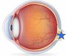 Which structure is tagged in the image below? a. CN II b. CN III c. CN ...