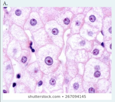 Calculate the total number of cells in photo A as shown below ...