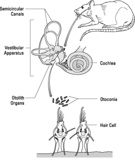 Presbycusis is an age-related hearing loss that is best described as: a ...