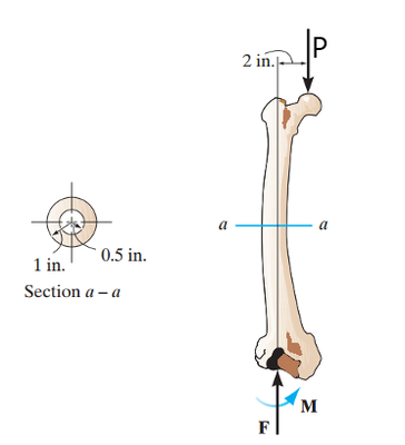Femur Cross Section Diagram Ultimate Strength Of The Human Femur