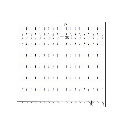 The slope field for the equation dP/dt = 0.0333333P(30 - P), for P \leq ...