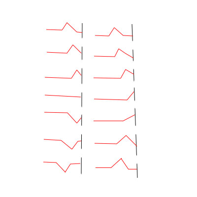 The diagram below shows two pulses. One is being reflected from a fixed ...