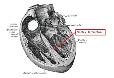 Wall between ventricles: ___ | Homework.Study.com