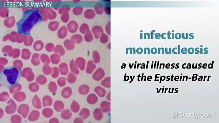 How Long Can A Lymph Node Stay Swollen After Mono Infoupdate Org